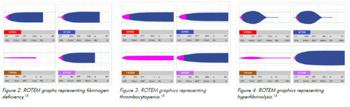 ROTEM and TEG in an obstetric setting – O&G Magazine