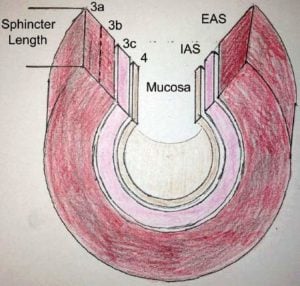Acute management of OASIS – O&G Magazine