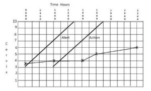 Partogram or instagram? – O&G Magazine