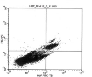 Q&a: fetal maternal haemorrhage screening – O&G Magazine