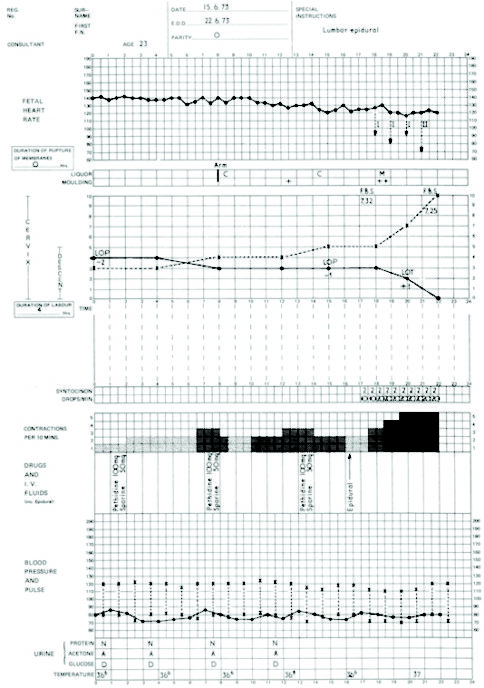 How accurate is our assessment of labour? Is there a place for the ...